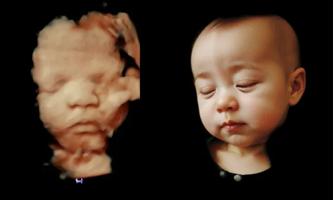 From Screen to Scene, We Turn Your 4D Ultrasound into Lifelike Art ...